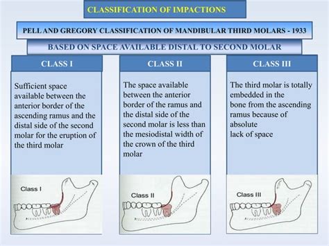 Impaction Pptx Dental Health Diseases And Conditions