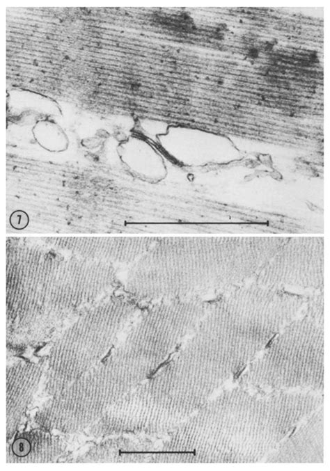 Crayfish Muscle Cross Section Incubated With 10 4 M Eserine No