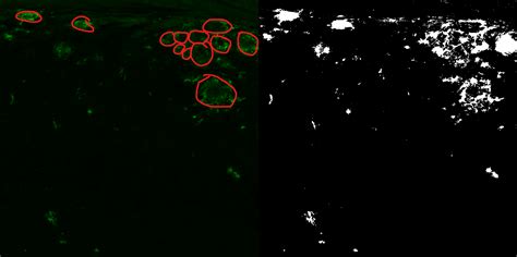 How To Count Dense Core Amyloid Plaques Using Imagej Or Matlab Researchgate