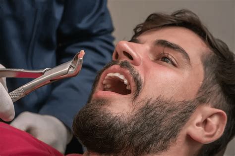 What Does A Blood Clot After Tooth Extraction Look Like