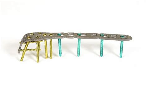 Lcp Olecranon Plates Right And Left Stainless Steel Titanium At ₹ 1860 Piece In New Delhi