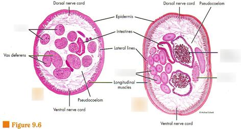 Phylum Nematoda Cross Sections Ascaris Mf Roundworm Diagram Quizlet