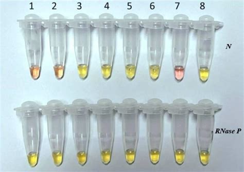 Color Visualization Of Rt Lamp Assay Pink Indicates Negative Yellow Download Scientific