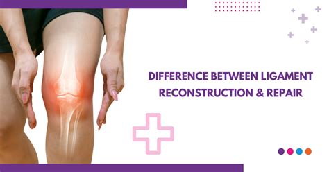 What Is The Difference Between A Strain And A Sprain