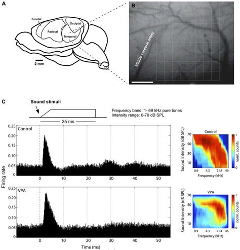 Electrophysiological Mapping Of The Primary Auditory Cortex A Download Scientific Diagram