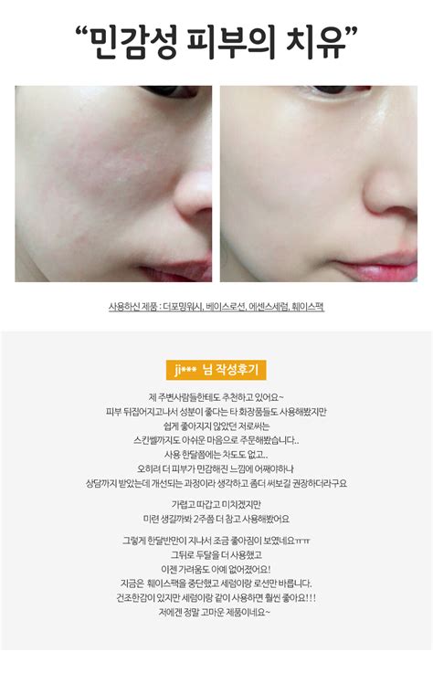 스킨쎌 세포과학연구소 민감성 피부의 치유 지금 자신의 피부를 위해서 사용하고 있는 화장품 샴푸의 성분을 따 져 보 세 요 🤔 퍼펙트 천연화장품 스킨쎌은 문제성