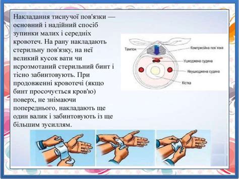 Невідкладна домедична допомога Види і наслідки кровотеч Невідкладна допомога при кровотечах