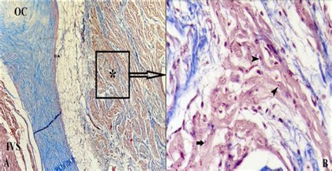 A A Histological View Of The Atrioventricular Node Atrioventricular Download Scientific