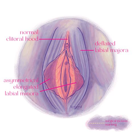 Labia Minora Anatomy
