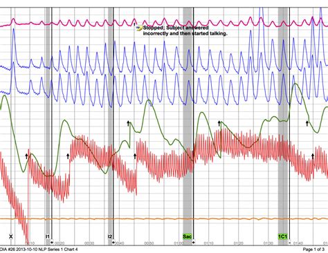 Leaked Documents Point To DIAs Inability To Detect Sophisticated Polygraph Countermeasures