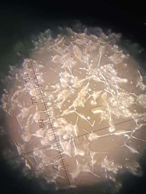 Why During Matrigel Drop Invasion Assay Pan02 Cells Die Researchgate