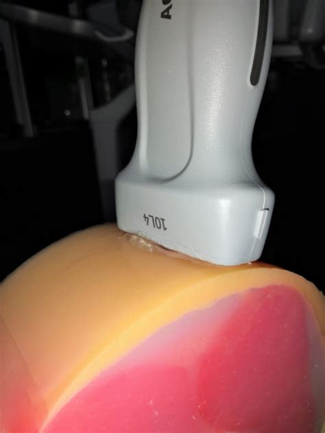 Localization Of The Ultrasound Probe In Ultrasound Elastography Using 3d Cameras Faps