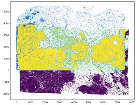 Aligning Partially Matched Serial Single Cell Resolution Breast Cancer Spatial Transcriptomics