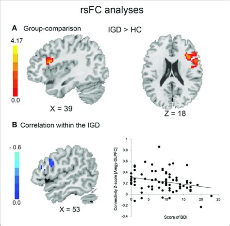Resting State Functional Connectivity In Igd And Hc Subjects A And Download Scientific
