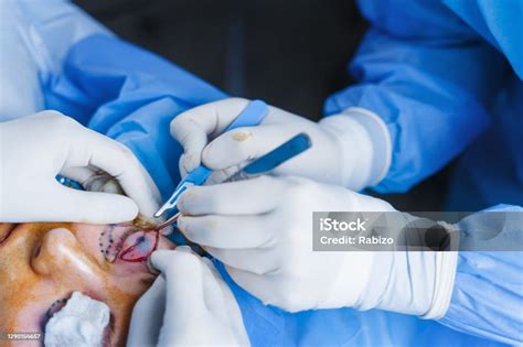 의료 진료소에서 얼굴의 눈 영역을 수정하기위한 안구 성형 수술 2 의사는 여성을위한 플라스틱 화장품 작업을 수행합니다 외과 의사는 눈꺼풀을 봉합 상단 부분에 대한 스톡 사진