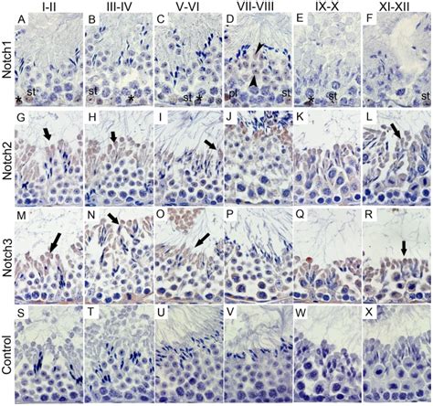 Positive Immunostaining In Brown Color Counterstaining With