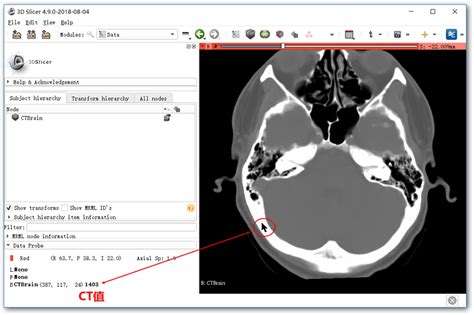 3dslicer中如何查看导入的ct图像的数据？ 问题求助 3dslicer中文论坛