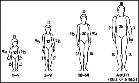 قانون نه تا در تعیین درصد سوختگی ها Rule 9 To Burn وبلاگ وان طب