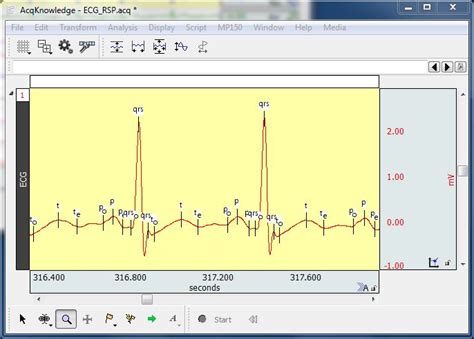 Ecg Cardiology Automated Ecg Analysis Research Biopac