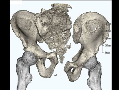 Figure 2 Three Dimensional Computed Tomography Ct On Arrival Ct