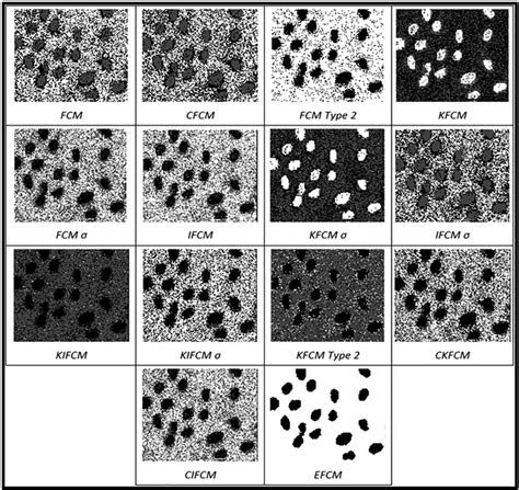 Segmentation Results For Bacteria Image Figure 6b Download Scientific Diagram