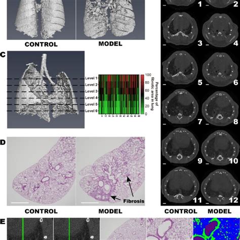 Characteristics Of The Bleomycin Induced Pulmonary Fibrosis Mouse Download Scientific Diagram