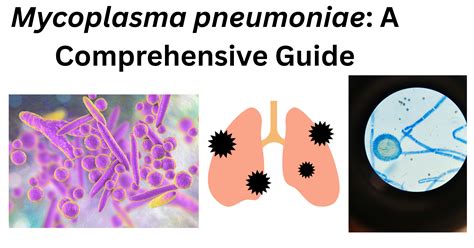 Mycoplasma Pneumoniae Bacteria Treatment