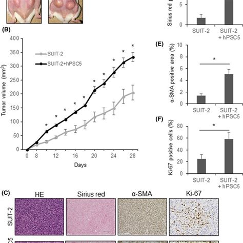 Cancer‐associated Fibroblasts Caf Promote Tumor Proliferation And