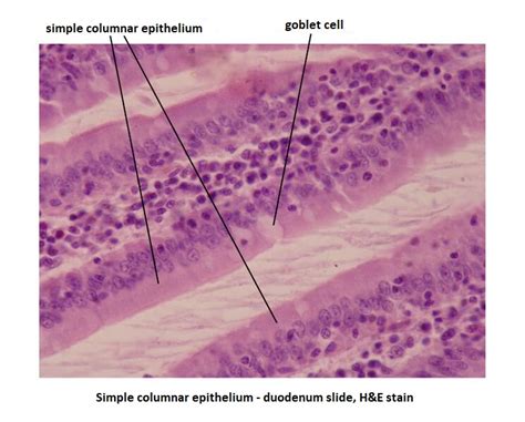 Simple Columnar Epithelium Image WikiLectures