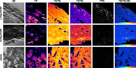 Nanosims Imaging Of Tissue Slices Secondary Electron Images Se And Download Scientific