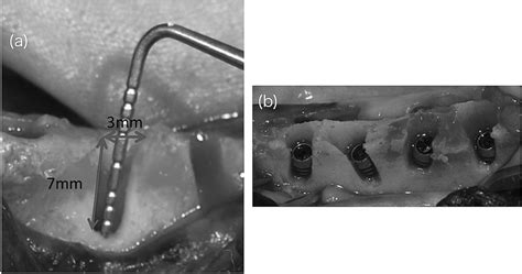 Photograph Of The Surgical Procedure A A Bone Defect Is Created On Download Scientific