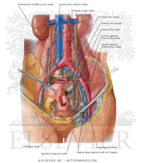 Lymph Vessels And Nodes Of Pelvis And Genitalia Female Lymphatic Drainage II Internal Genitalia