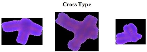 Examples Of Overlapping And Cross Chromosome Clumps Download Scientific Diagram
