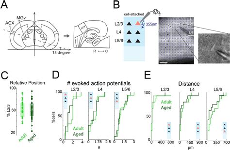 Sex Specific Age Related Changes In Excitatory And Inhibitory Intracortical Circuits In Mouse