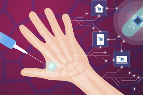 Microchip Implants Are Threatening Workers Rights Delano News