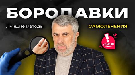Бородавки правила профилактики лечение самолечение Youtube