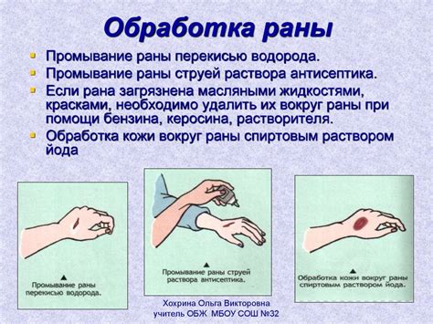 Первая помощь при порезах и ссадинах у детей: 4 правила обработки ран ...