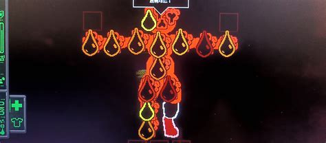 Comments 549 To 510 Of 858 Casualties Unknown By Orsoniks