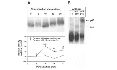 Rat Liver Nf κb Dna Binding Activity After Different Times Of Perfusion Download Scientific