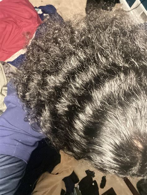 Update 10 Months Dutasteride 1 Mg Daily And 2 5 5mg Oral Minoxidil Daily On 25m With Diffuse