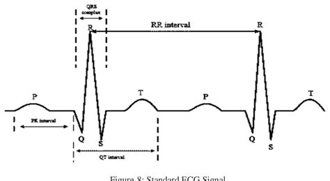According To 9 10 The Normal Values Of Ecg Parameters