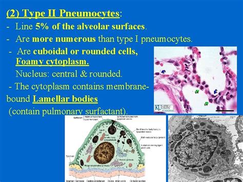 Respiratory System Ii Histology Of Intrapulmonary Bronchi Bronchioles