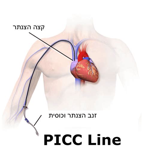 Midline Vs Picc Line Difference And Comparison