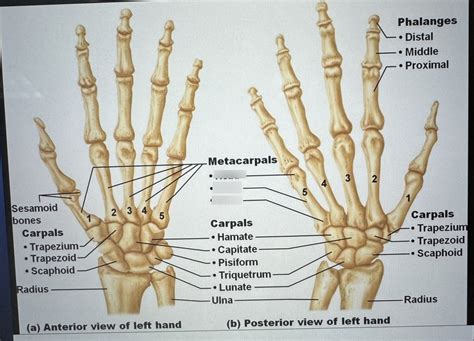 Kinesiology Test 2 Metacarpal Landmarks Diagram Quizlet