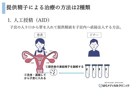 国内初 、精子バンク利用による非配偶者間体外受精・顕微授精 Ivf D を開始｜infoseekニュース