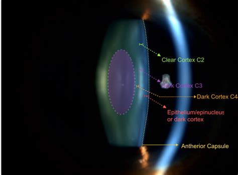 Layers Of The Lens Cortex Download Scientific Diagram