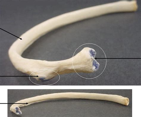 Rib Head Tubercle Costal Groove Diagram Quizlet