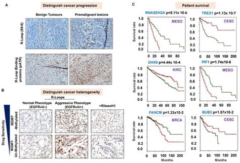 Pathophysiological Role And Diagnostic Potential Of R Loops In Cancer