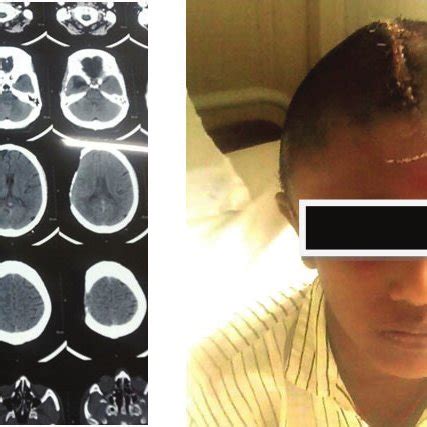Radiographic Evaluation CT Scan Images Of The Patient Download Scientific Diagram