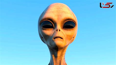 110 عمل زیبایی یک پسر برای تبدیل شدن به آدم فضایی عکس قبل و بعد